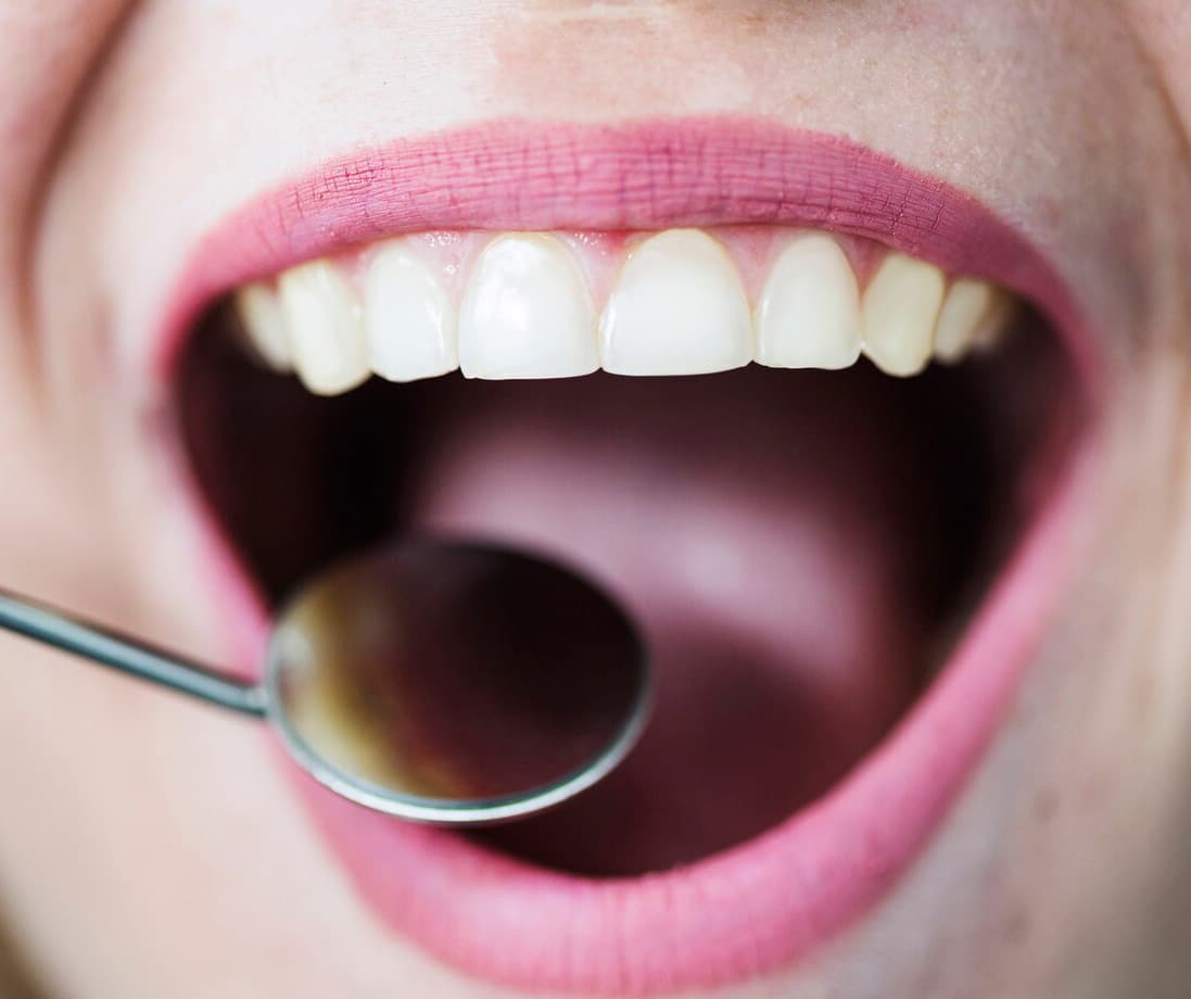 Cheat Dentist and How Preferred Provider Schemes Work